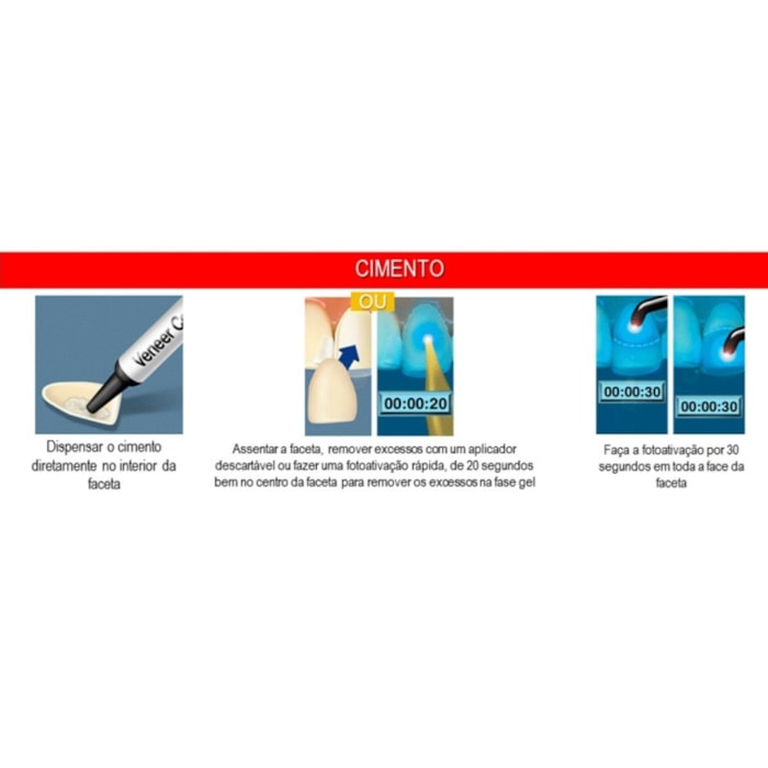 Cimento Resinoso 3M™ Foto RelyX™ Veneer - Solventum